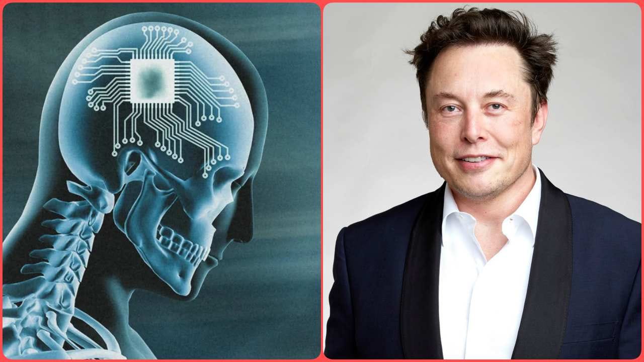 Elon Musk પોતાના મગજમાં લગાવશે બ્રેઈન ચિપ! જાણો શું છે Neuralink ...