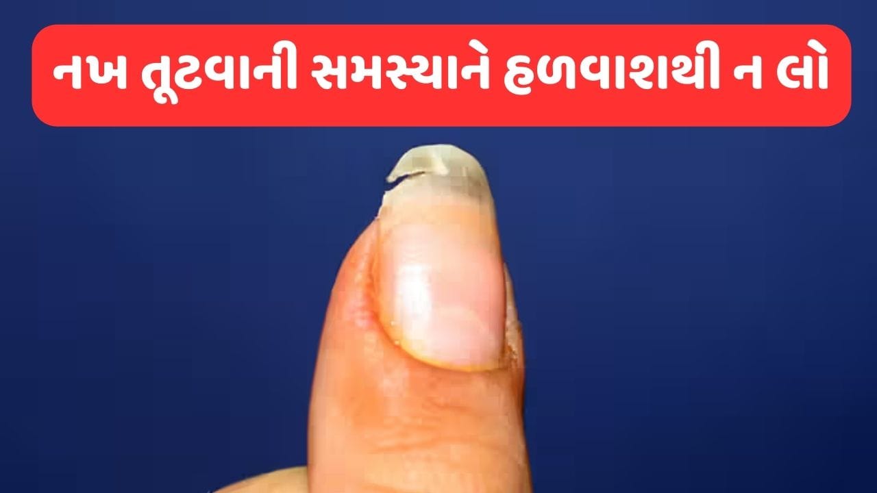 Broken nails : શું તમારા નખ પણ વારંવાર તૂટે છે ? આ સમસ્યાને હળવાશથી ન ...