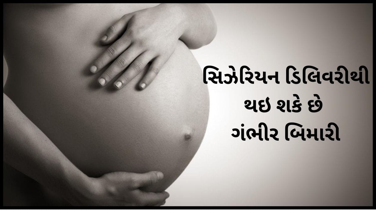 C-Section Delivery : સિઝેરિયન ડિલિવરીથી થઇ શકે છે ઘણા નુકસાન, મહિલાઓ ...