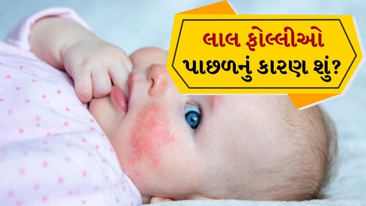 નાના બાળકોની સ્કીન પર લાલ ફોલ્લીઓ કેમ દેખાય છે, શું આ કોઈ રોગનું લક્ષણ ...