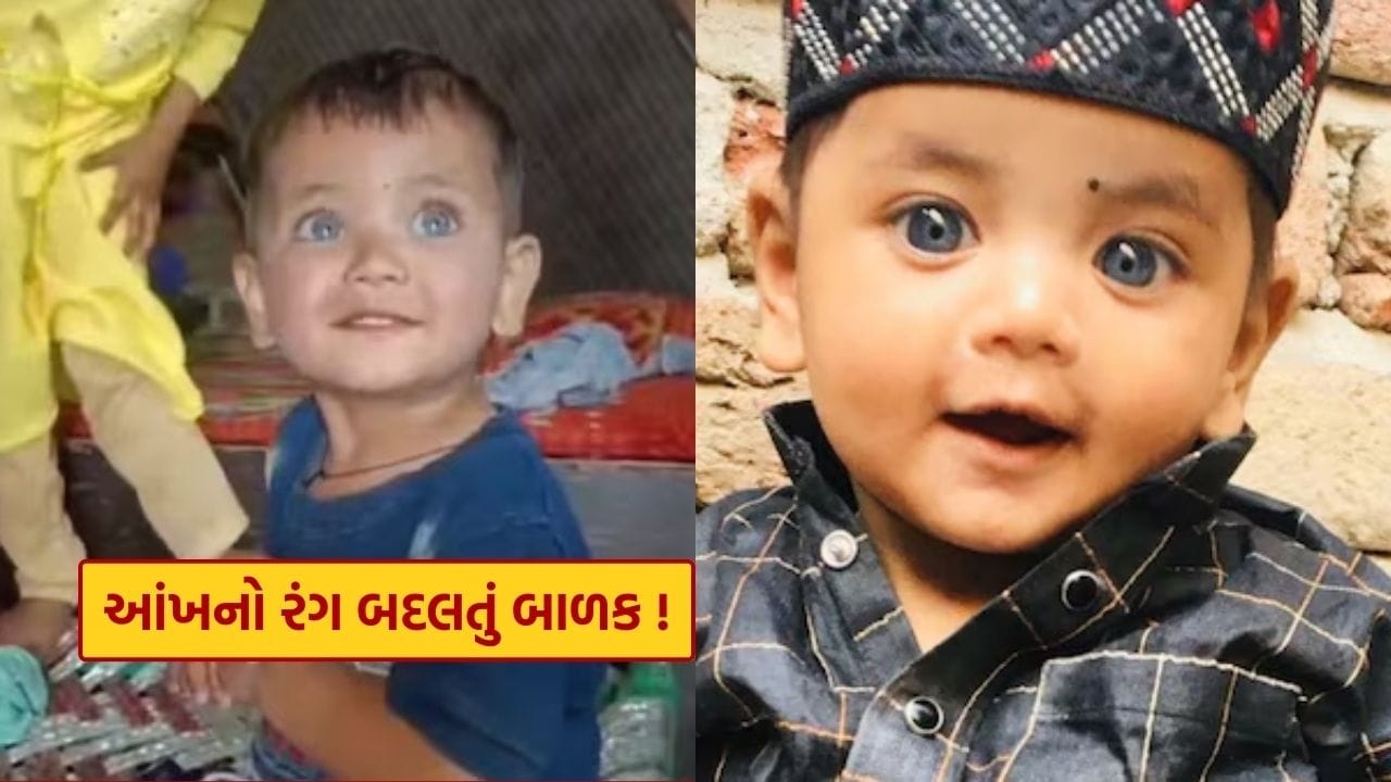 Viral Video : કુદરતની કરામત ! કપડાંના રંગની જેમ બદલાય છે બાળકની આંખોનો ...