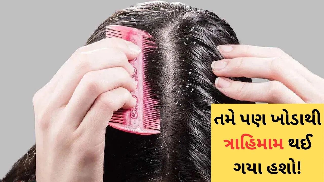 Health : ચોમાસામાં તમે પણ ખોડાથી ત્રાહિમામ થઈ ગયા હશો ! ખોડાને જલદી દુર કરવા અપનાવો આ રીત ...